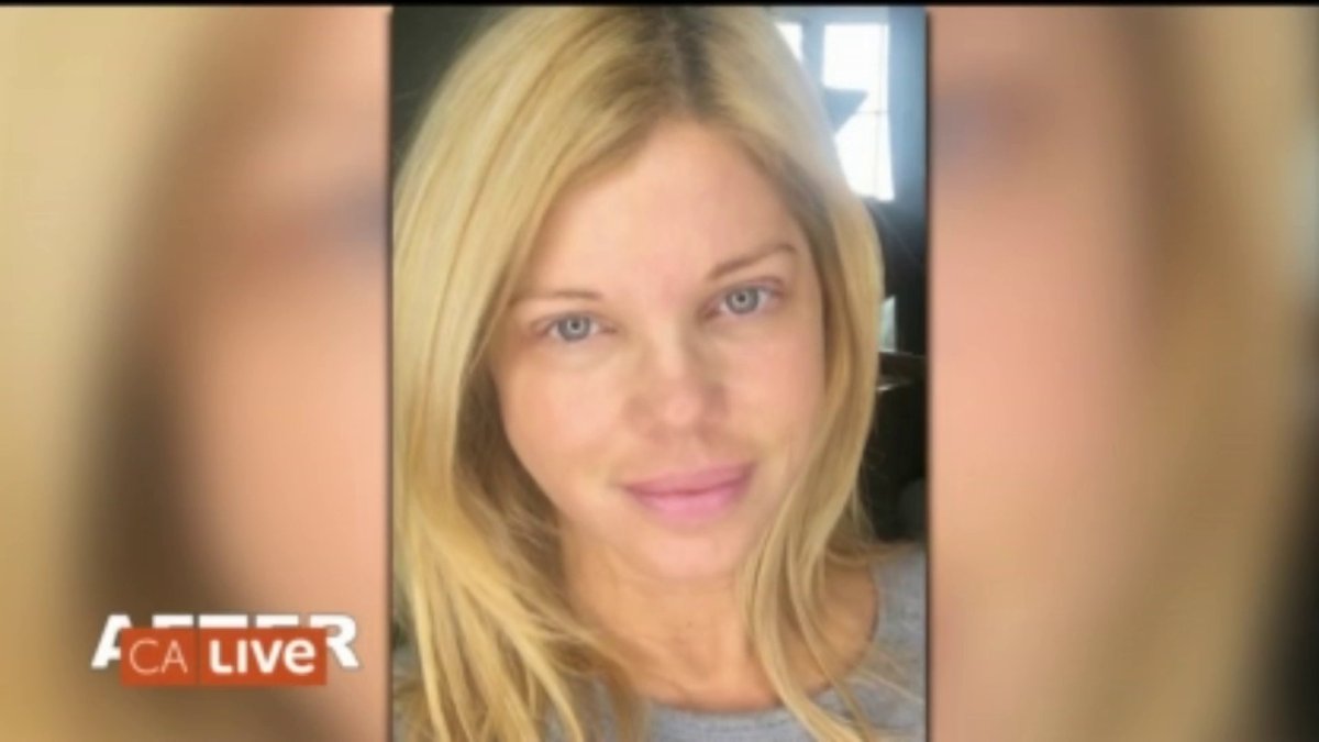 Watch a Baywatch Beauty Turn Back Time With This Innovative Beauty ...