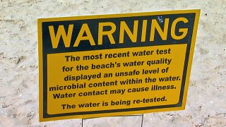 Beach goers urged to avoid ocean water after overnight rain – NBC Los ...