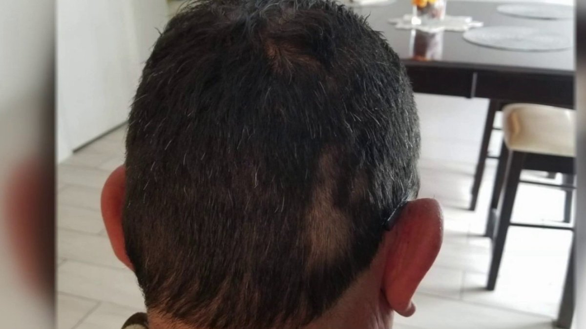 Stylists Plead, ‘Don’t Touch Your Hair!’ – NBC Los Angeles