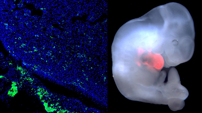 Scientists Take First Steps to Growing Human Organs in Pigs – NBC Los ...