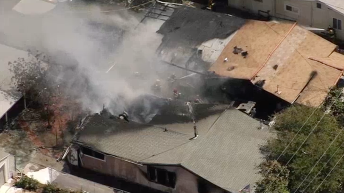 Firefighters Injured in Orange – NBC Los Angeles