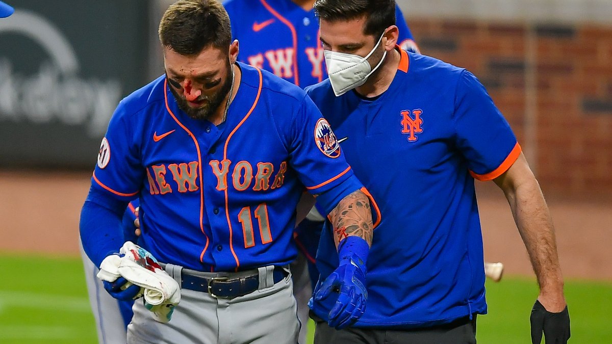 Mets’ Kevin Pillar Has Multiple Nasal Fractures After Scary Hit by Pitch – NBC Los Angeles