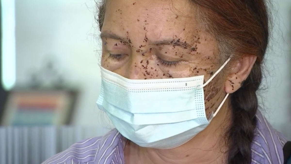 Victims of South LA Fireworks Explosion File Claims Against City – NBC ...