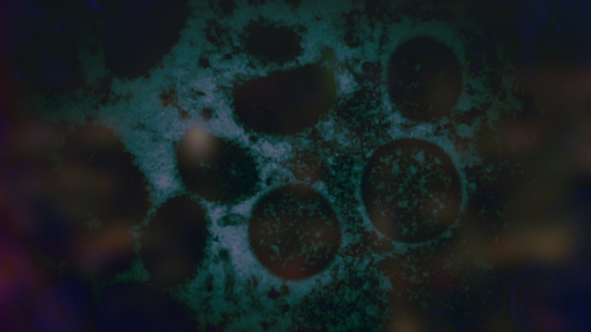 Monkeypox Cases Rise in Riverside County – NBC Los Angeles