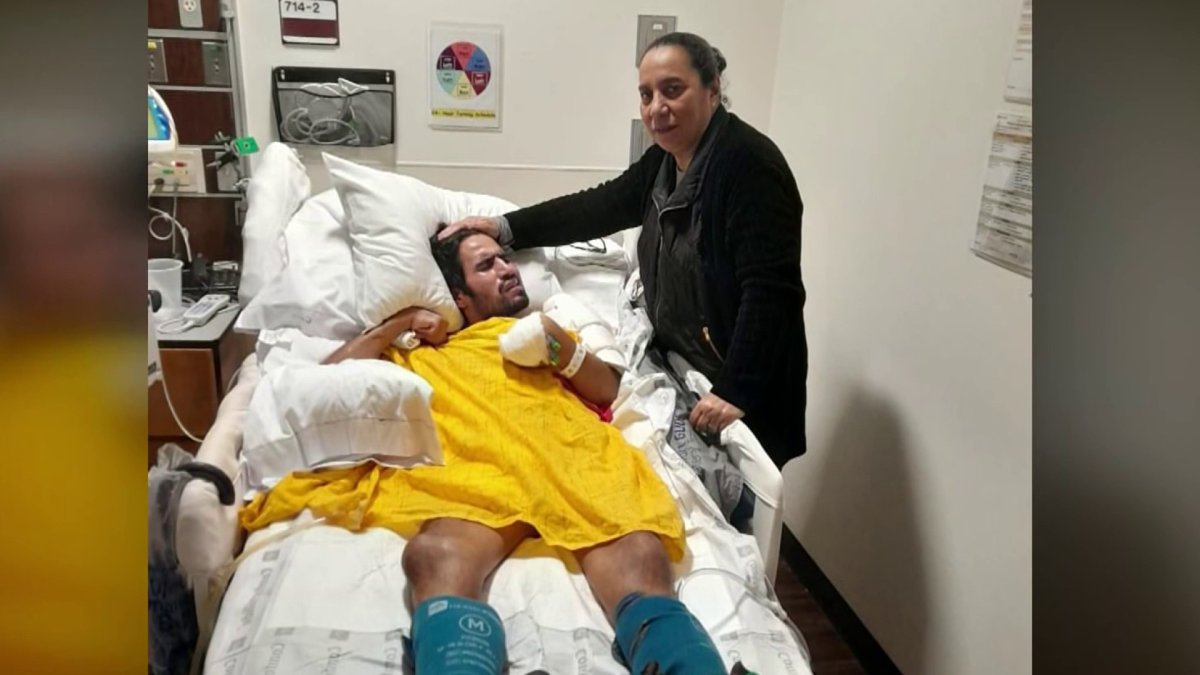 Driver Sought After Severely Injuring Man In La Nbc Los Angeles