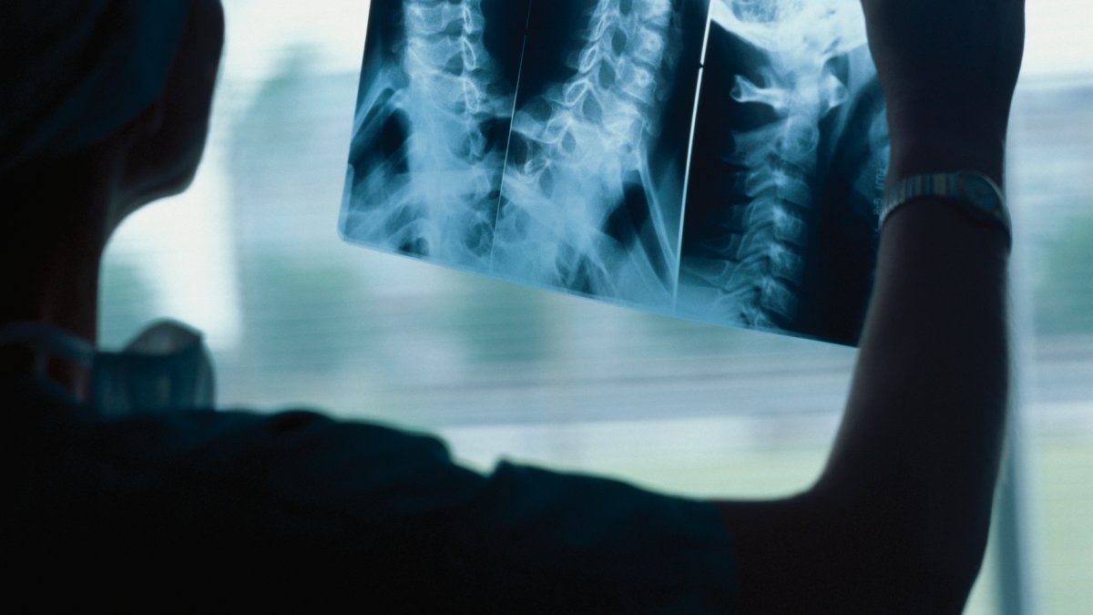A Washington Woman With Tuberculosis Refuses Treatment, so Authorities ...