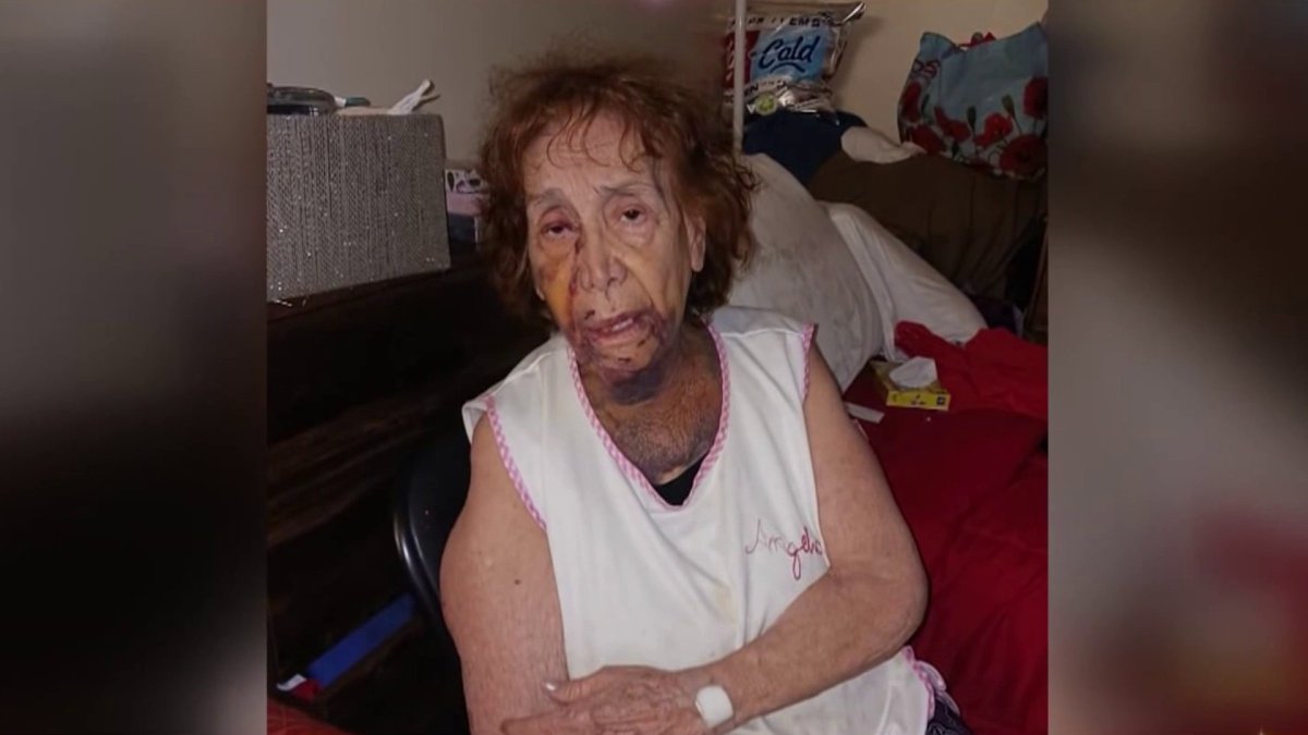 Neighbor describes attack on woman by serial beating suspect – NBC Los ...