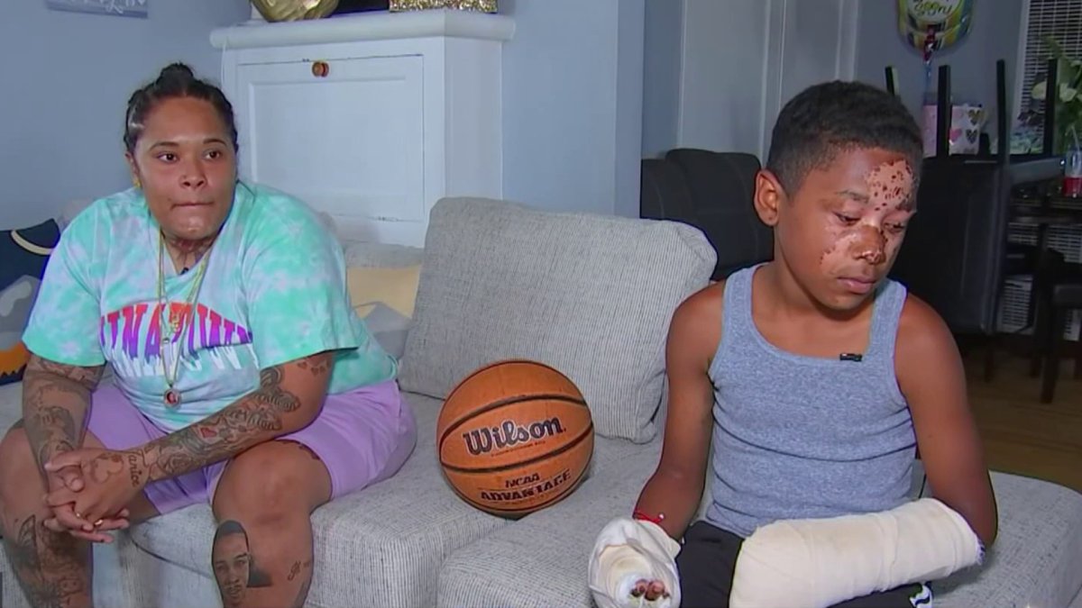 ‘I didn’t think it would happen to me’: 12-year-old loses hand to ...