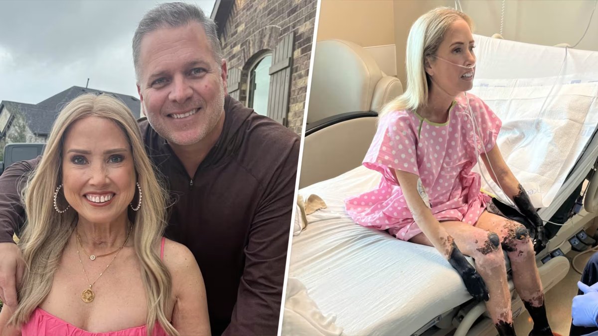 Woman’s strep infection leads to sepsis, ‘mummified’ hands and feet ...