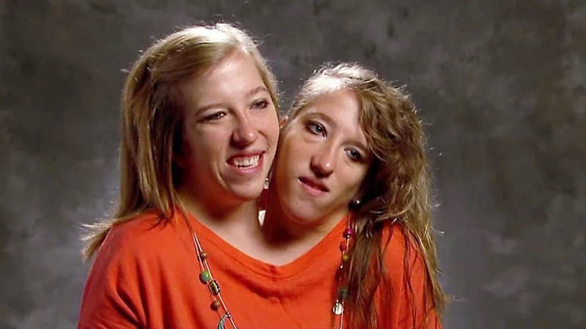 Conjoined twin Abby Hensel is married – NBC Los Angeles
