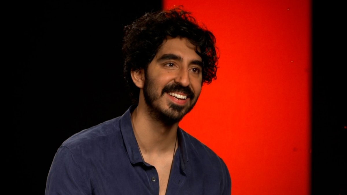 Dev Patel look-alike contest to be held in San Francisco – NBC Los Angeles