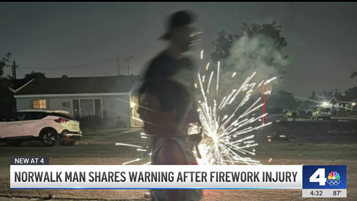 Norwalk man shares warning after frightening firework injury – NBC Los ...