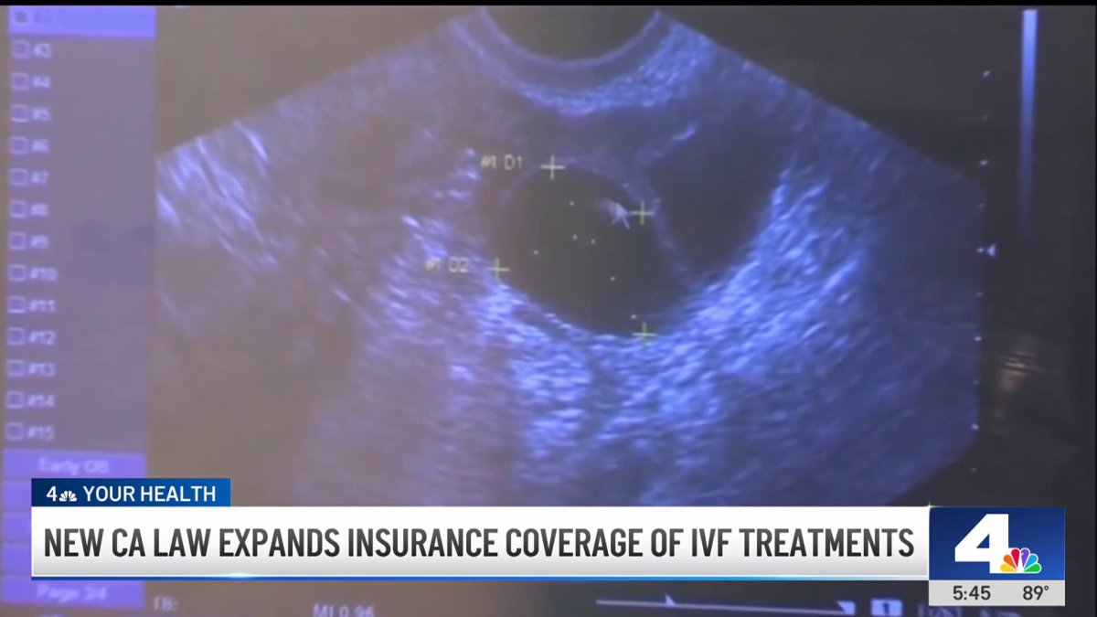 New state law expands insurance coverage of fertility treatments – NBC ...