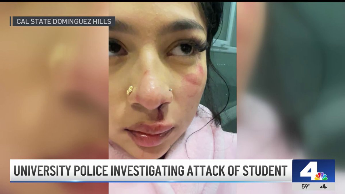 CSUDH student says she was assaulted on campus – NBC Los Angeles