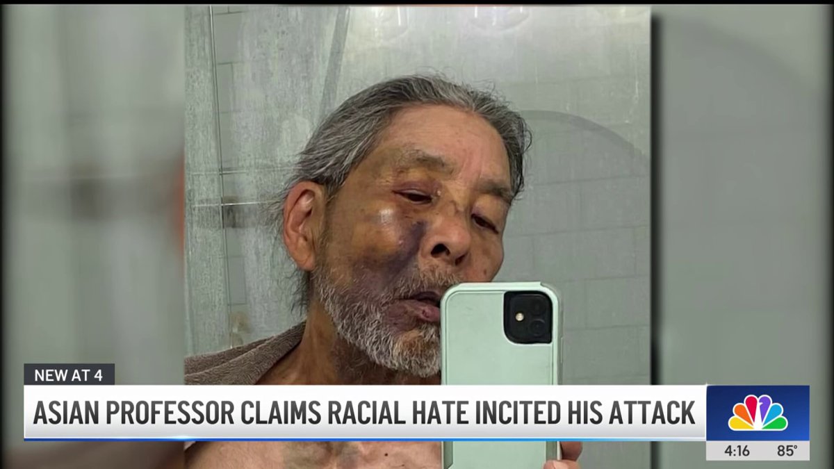 Asian professor reeling from injuries in possible hate crime – NBC Los ...