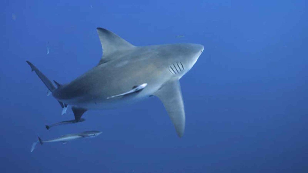 9-year-old girl survives shark attack in Florida – NBC Los Angeles