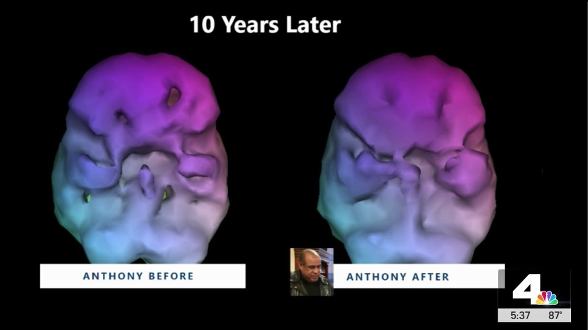 NYC gunman claims to have had CTW. What we know about disease – NBC Los ...