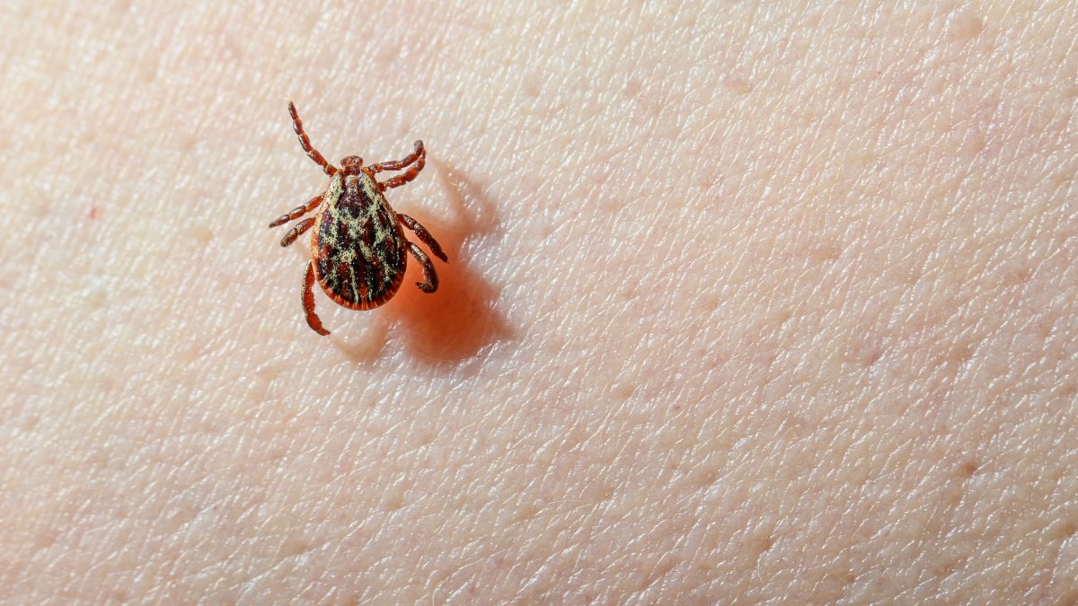 Tick season seems to be off to a fast start – NBC Los Angeles