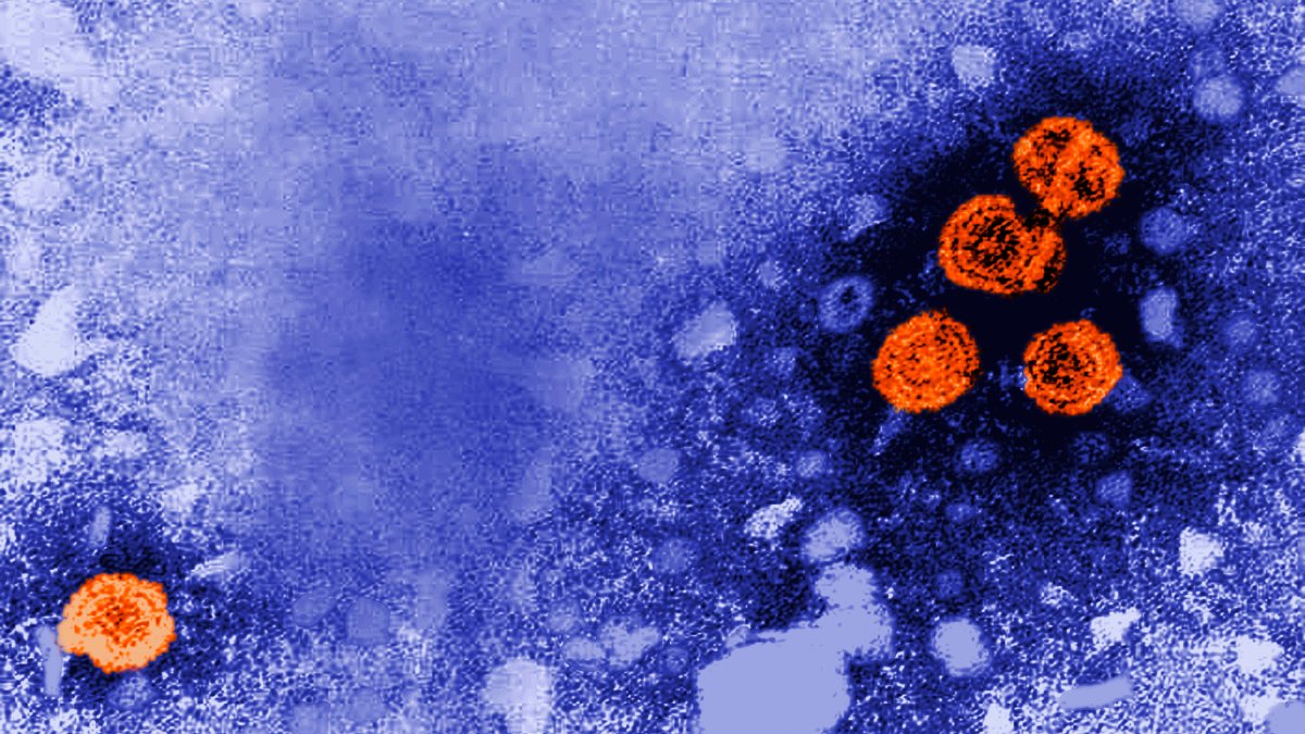 Experimental hepatitis B drug might offer ‘functional cure’ – NBC Los ...